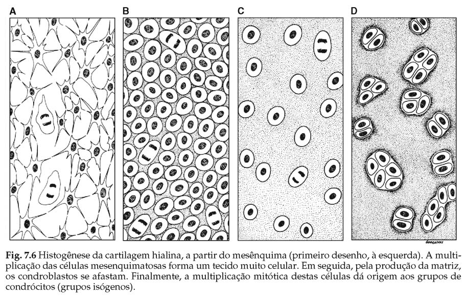Patologias Humanas : Tecido Cartilaginoso