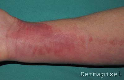 Dermapixel: febrero 2013