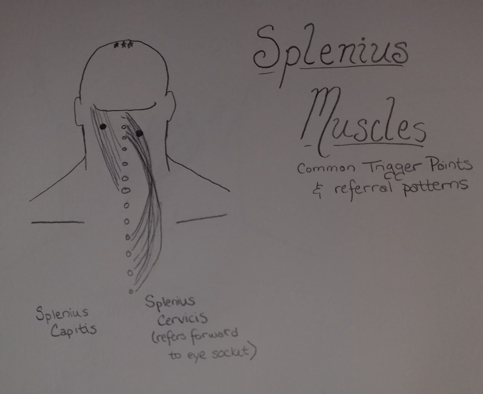 Trigger Point: Splenius Muscles