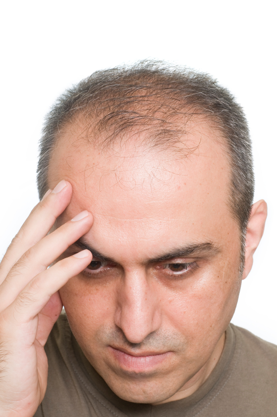 colehodge: Salman Khan Hair Loss Photos : Acne Treatment Skin Care ...