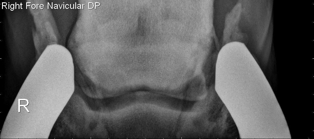 Michael Porter, Equine Veterinarian: Navicular bone cyst in sound horse!