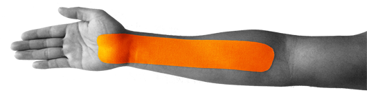 ARES Kinesiology Tape: Arestape Applications - Wrist Pain