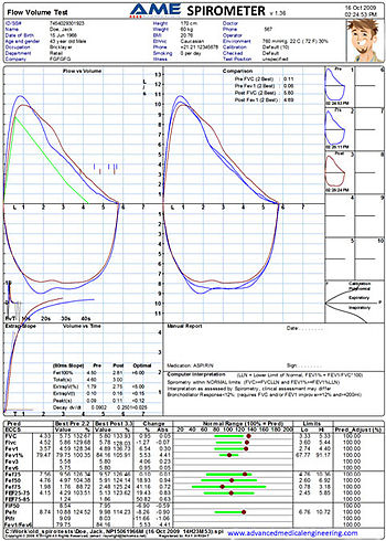 Asthma and You: What are pulmonary function tests (PFTs), spirometry ...