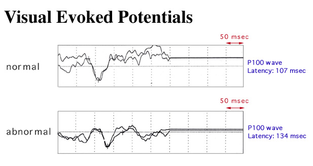 Journal and Conferences on Biomedical Engineering: Enhancing Visual ...