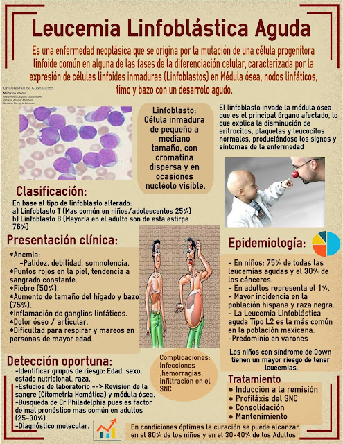 DIVULGACIÓN CIENTÍFICA UG: Leucemia Linfoblástica Aguda