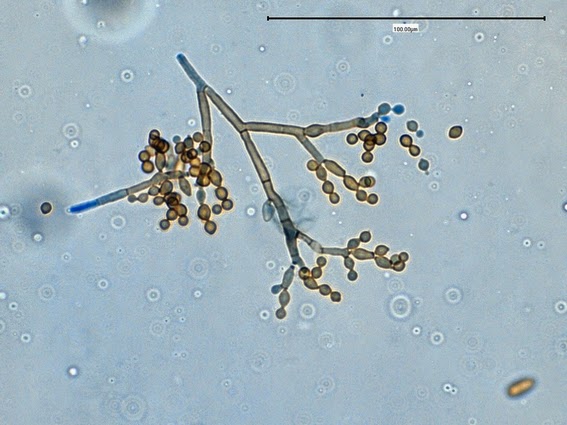 Fun With Microbiology (What's Buggin' You?): Cladosporium species ...