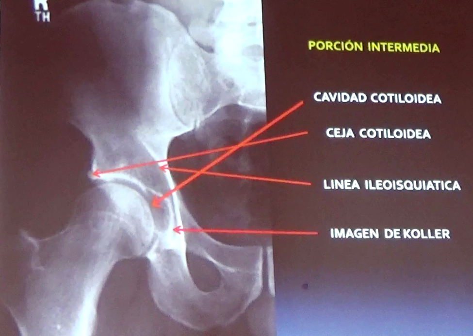 RADIOANATOMIA: septima clase