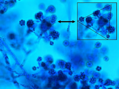 Fun With Microbiology (What's Buggin' You?): Trichoderma species