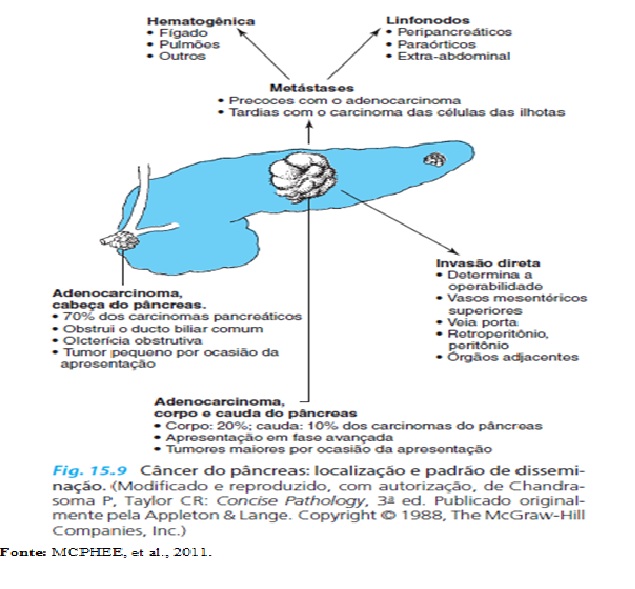 Atlas virtual de histologia e patologia: [CC II: #9] ADENOCARCINOMA DE ...