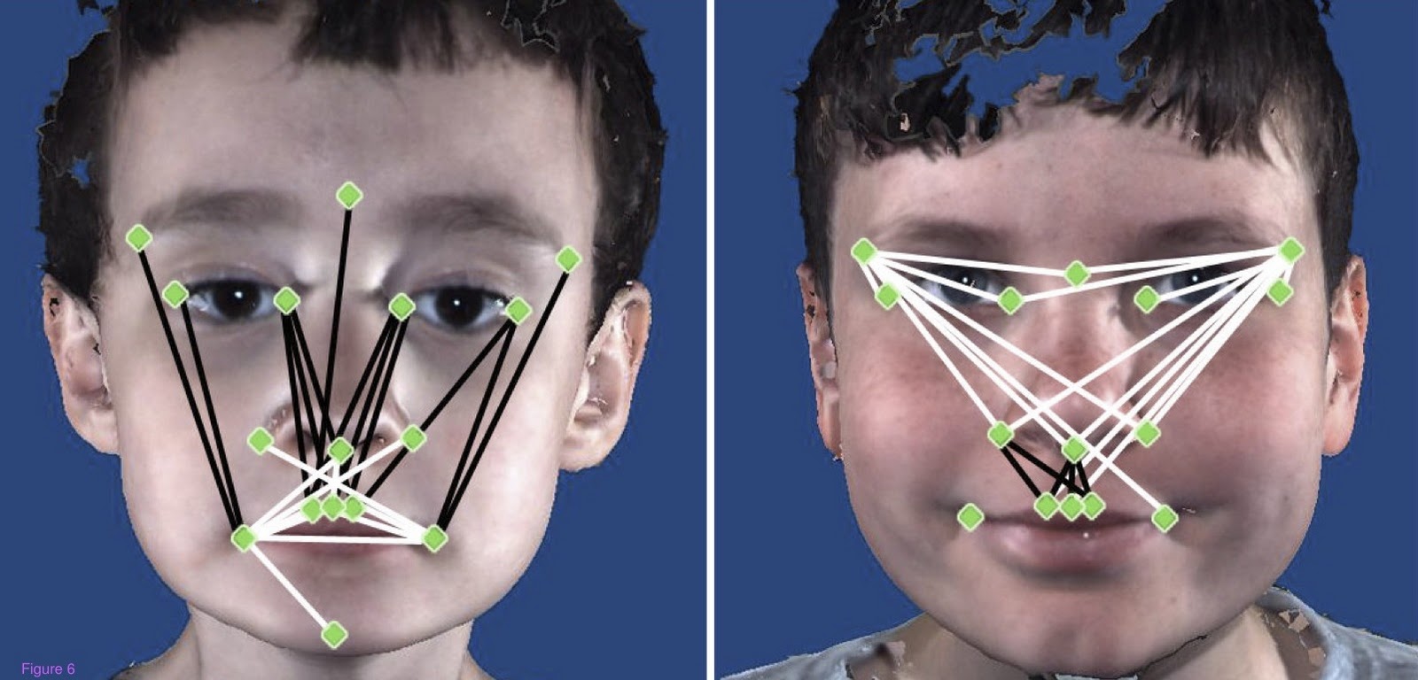 Black lines indicate a reduced distance, white lines indicate an increase