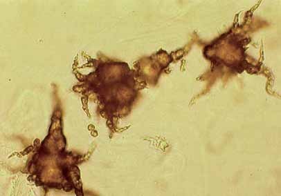 [Haematology] Microscopic Examination of Urinary Sediment - Crystals ...