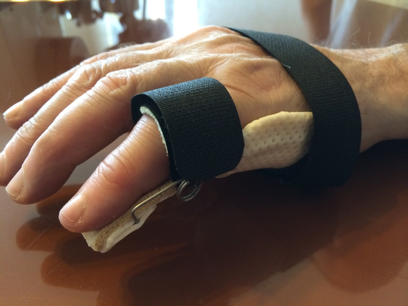 Orthèses Main-Poignet Lyon : photos