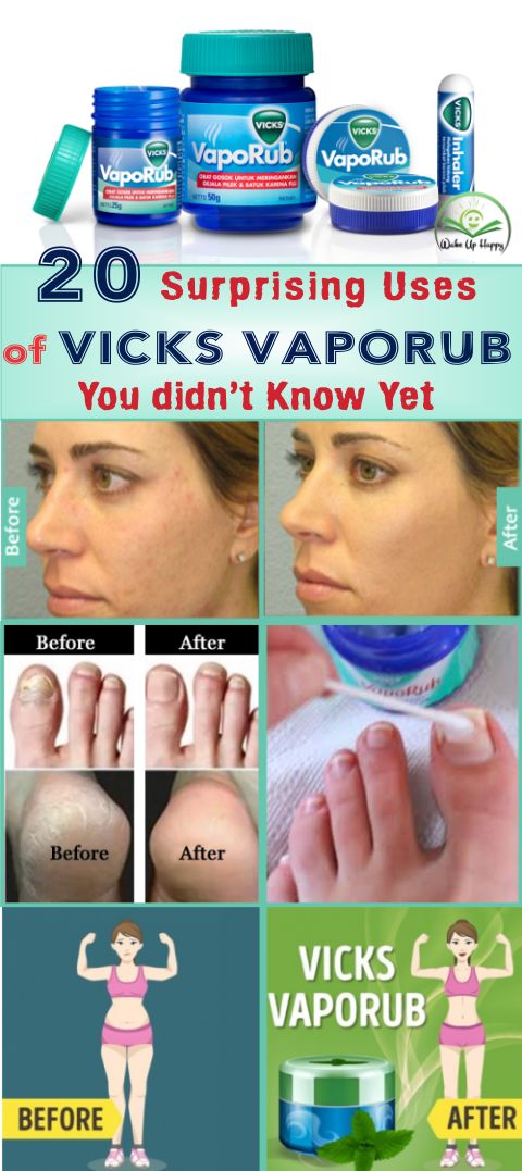 20 Surprising Uses Of Vicks Vaporub You Didnt Know Yet Health Pills