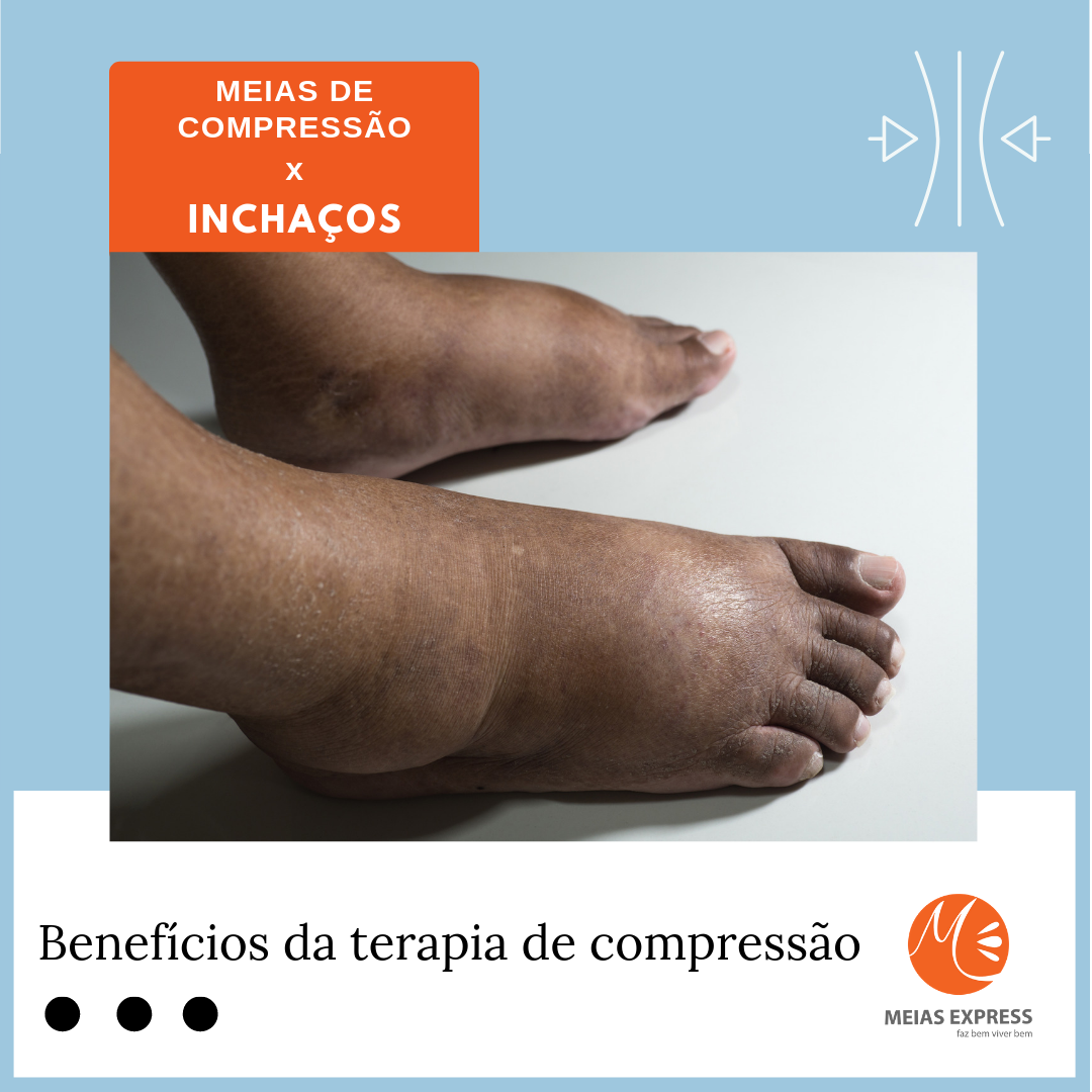 Pernas inchadas: e agora? - Meias Express