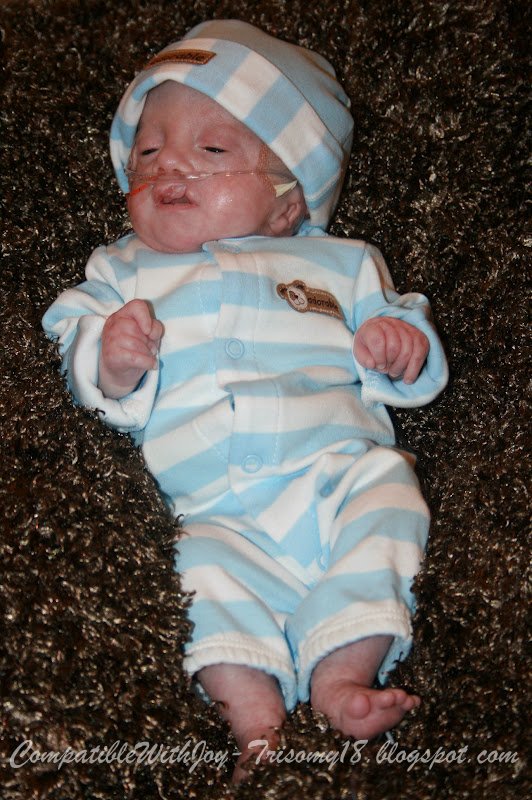 Compatible With Joy-Trisomy18: Correcting Aaron's Rocker Bottom Feet