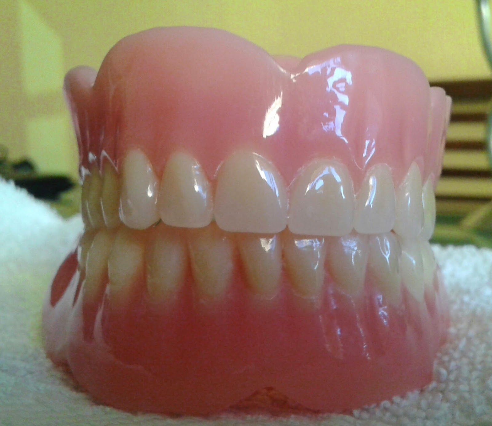 El protésico en sevilla.: Prótesis parcial y Prótesis completa