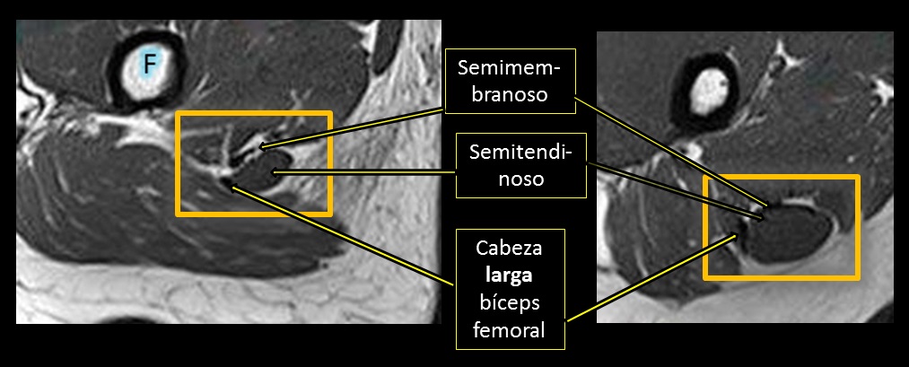 LABORATORIO DE IMÁGENES: Clase 7 - MUSLO