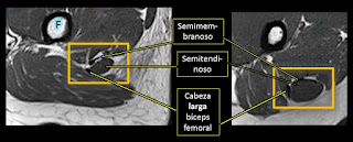 LABORATORIO DE IMÁGENES: Clase 7 - MUSLO