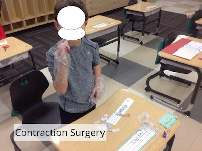 Teaching Little Miracles: Contraction Surgery