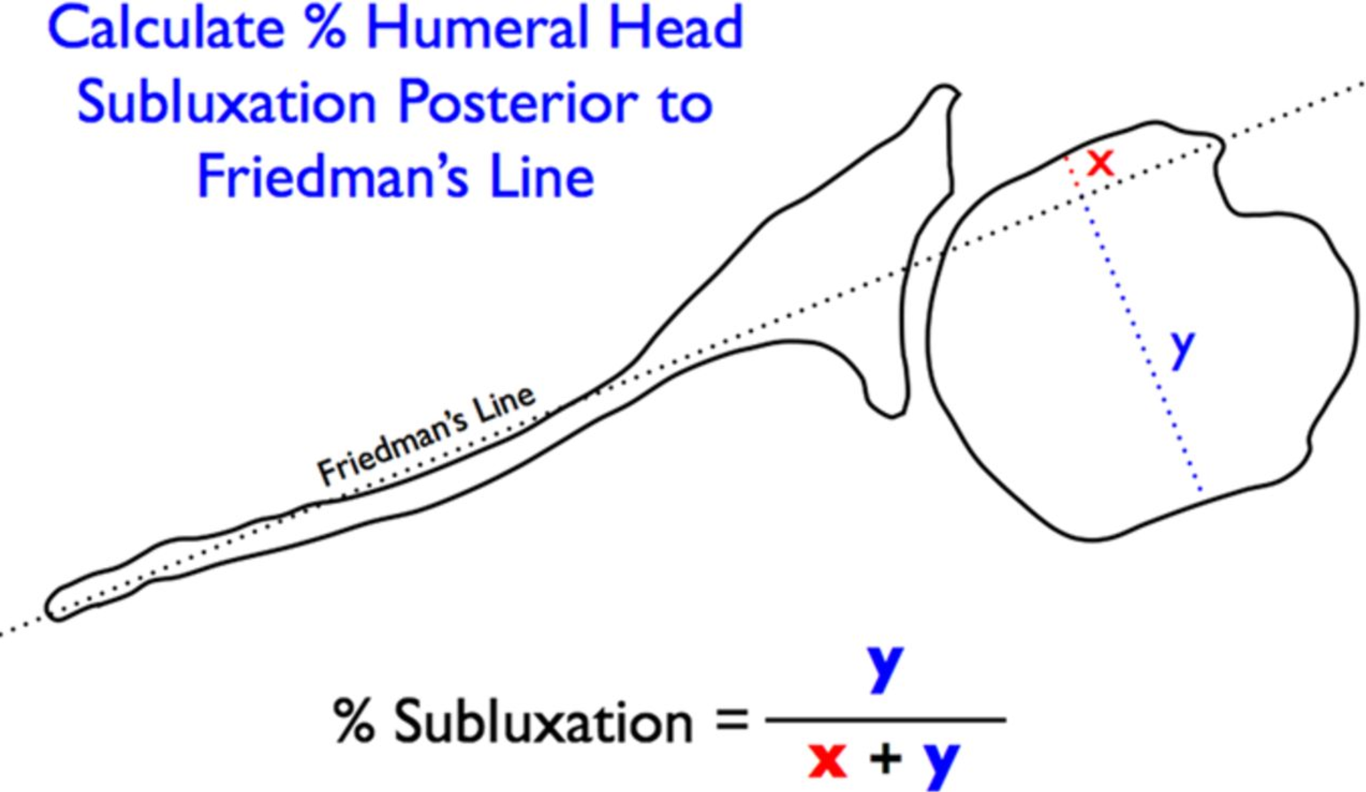 Shoulder and Elbow Surgery: Shoulder arthroplasty for osteoarthritis in ...