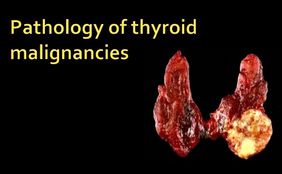 Naravna znanost o zdravju: ŽLEZA ŠČITNICA (TIROIDNA ŽLEZA)