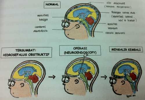 tips dan trik: Inilah Penjelasan Lengkap, Kenapa Seorang Anak Bisa ...