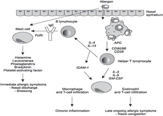 Tugas Sampah Koas: THT-RHINITIS ALERGI