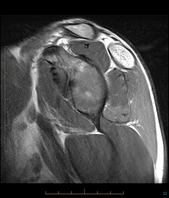 Radiology Cases: 2011