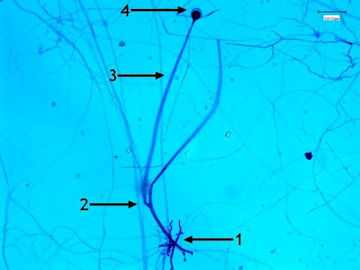 Fun With Microbiology (What's Buggin' You?): Absidia corymbifera ...