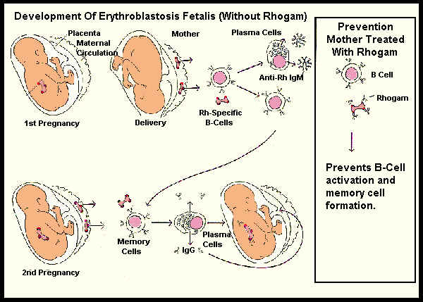 Haemolytic Disease of the Newborn (HDN)