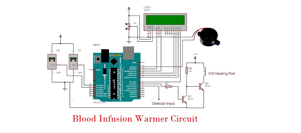 Blood Infusion Warmer using Arduino - Leets academy