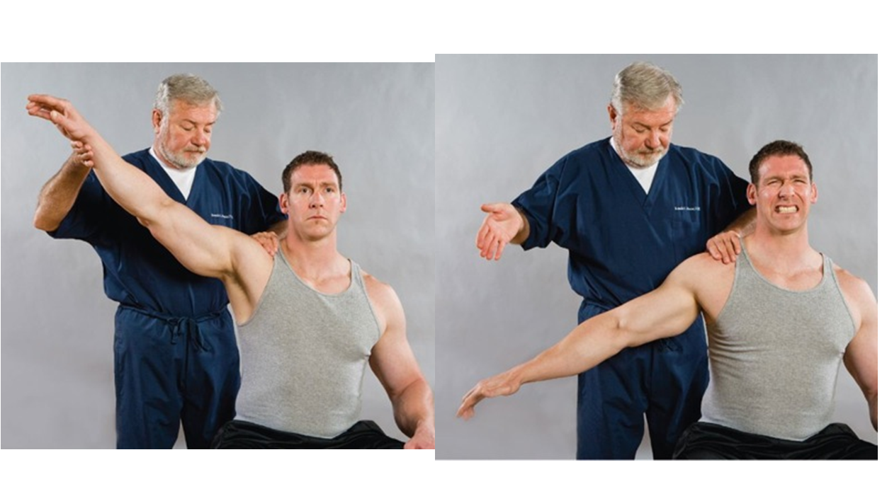 Drop Arm ~ ARTIKEL FISIOTERAPI