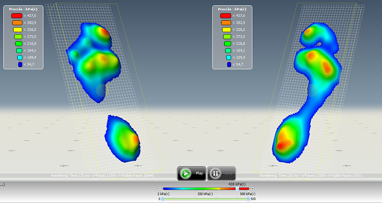 Clínica e Cirurgia do Pé e Tornozelo: Baropodometria - Teste da Pisada