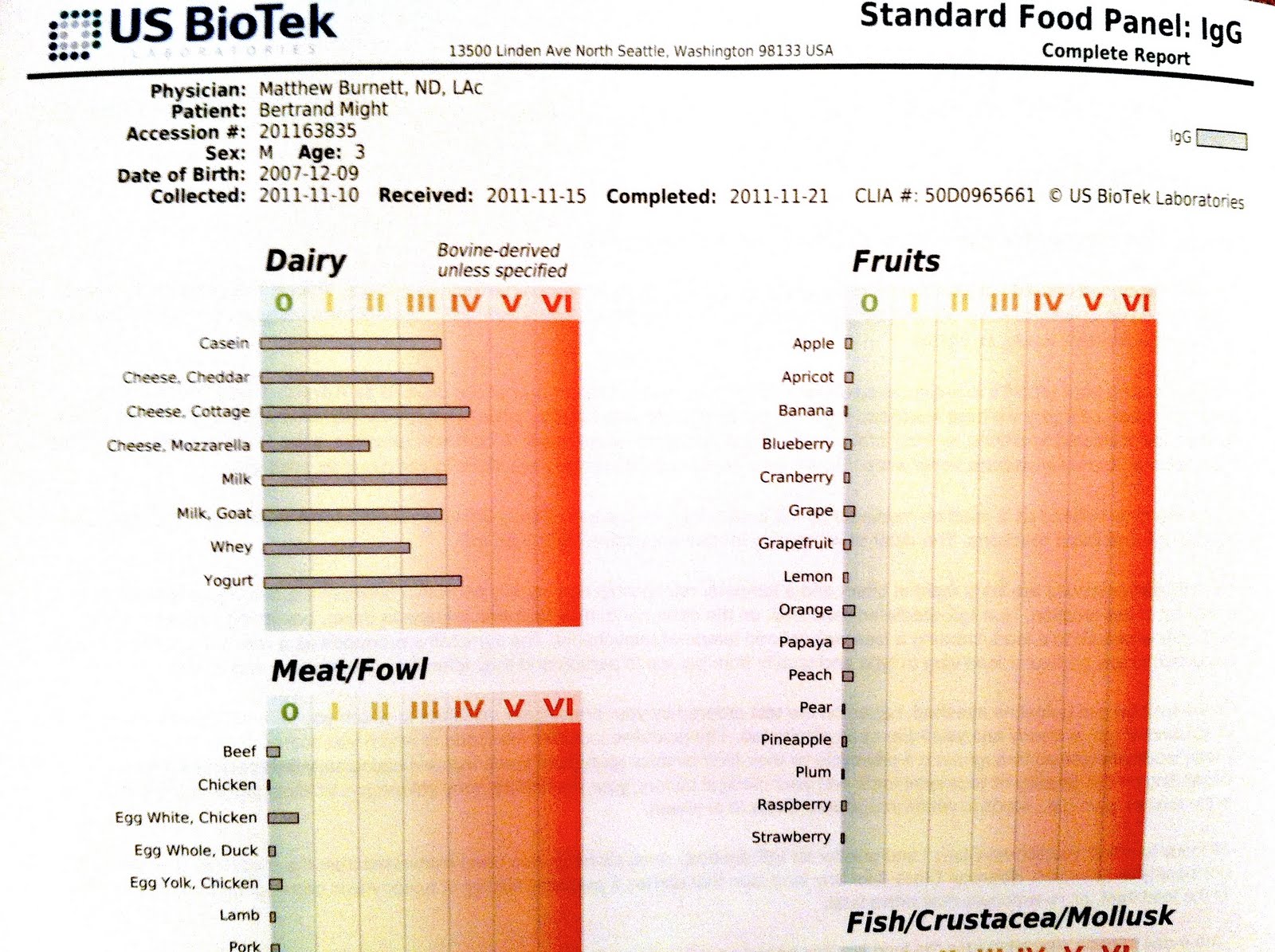 Overcoming Movement Disorder: Food Sensitivity