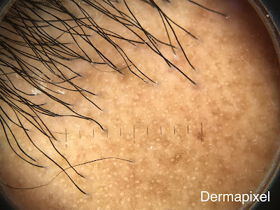 Dermapixel: enero 2018
