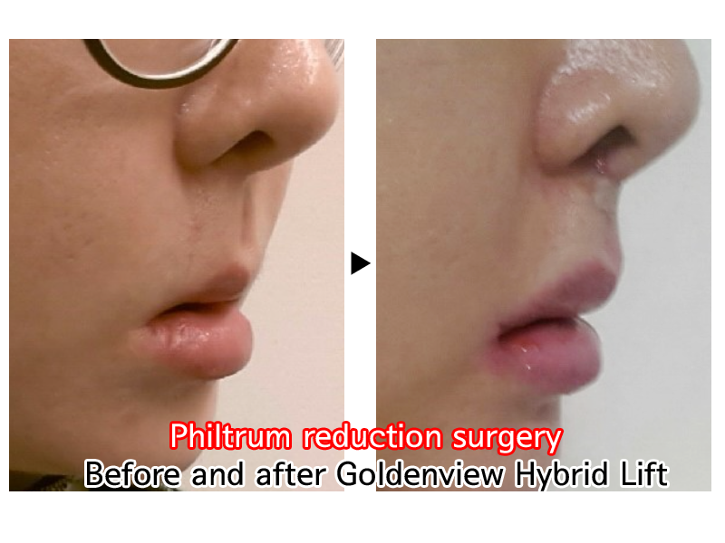 Goldenview Plastic surgery: 10월 2016