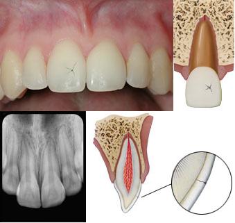 Dentistry lectures for MFDS/MJDF/NBDE/ORE: A Note On Definition ...