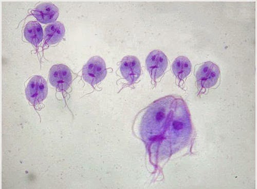 Medical Laboratory and Biomedical Science: Family Portrait of Giardia