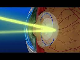 Mag het een beetje meer zijn: 16. Nastaar