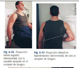 PRODUCCION Y TRATAMIENTO DE IMAGENES DIAGNOSTICAS: CAPITULO HUMERO Y ...