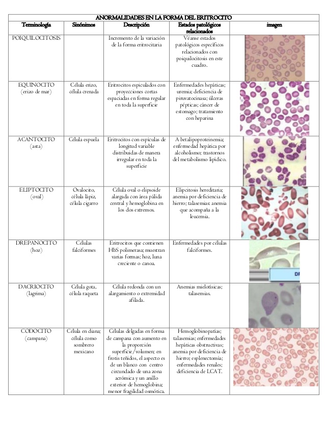 Laboratorista Clínico Majos: Anormalidades de los eritrocitos