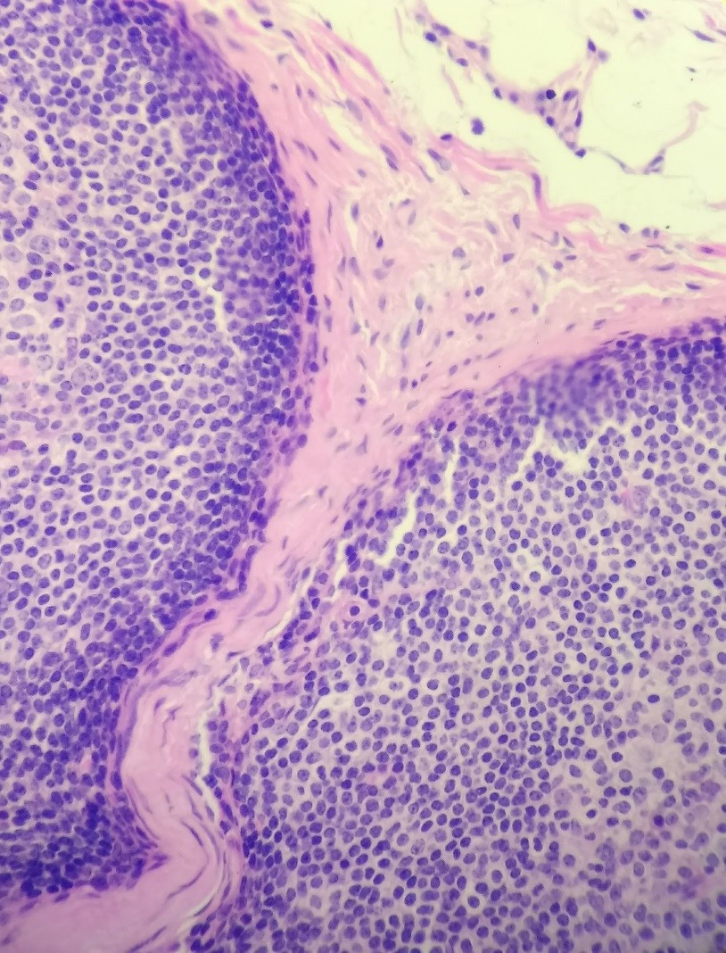 Manual interactivo de tejido conectivo: Tejido conectivo colágeno ...