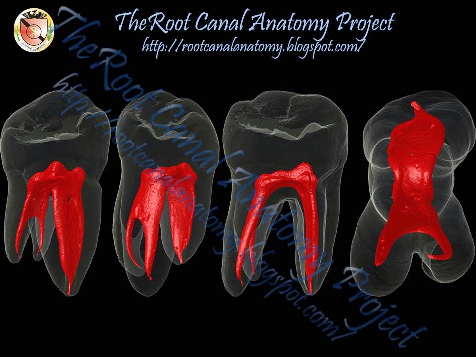 The Root Canal Anatomy Project: March 2014