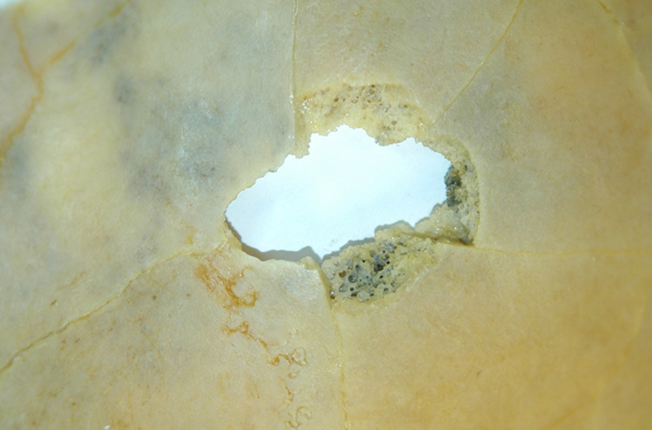 Forensic Pathology Blog