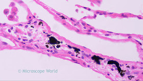 Microscope World Blog: Human Lungs under the Microscope