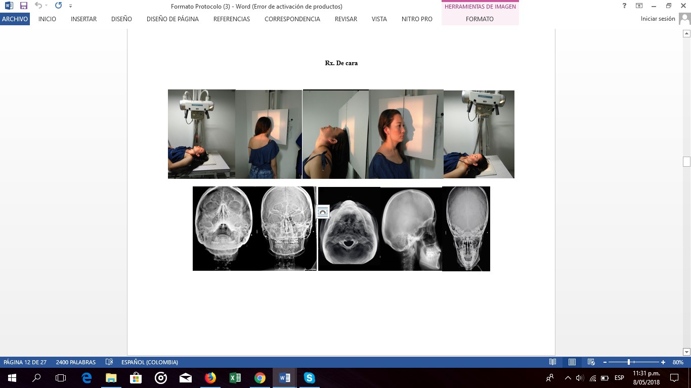 Trabajo colaborativo de Tórax, Abdomen, Cráneo y Cara.: Caso Cuatro