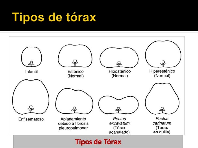 katherine Massiel (semiologia quirurgica): EXAMEN DEL TORAX
