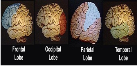 ASUHAN KEPERAWATAN: ASUHAN KEPERAWATAN STROKE HEMORAGIC