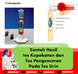 Contoh Hasil Tes Kepekatan dan Tes Pengenceran Pada Tes Urin