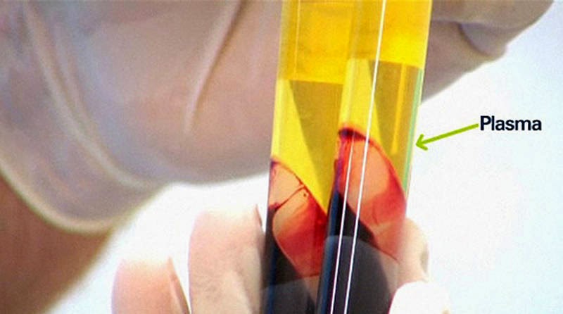BIOLOGÍA APLICADA 4ºA-4-2014: LA SANGRE